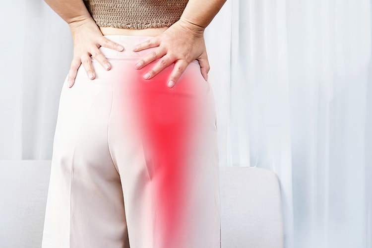 How to Relieve Sciatica Pain